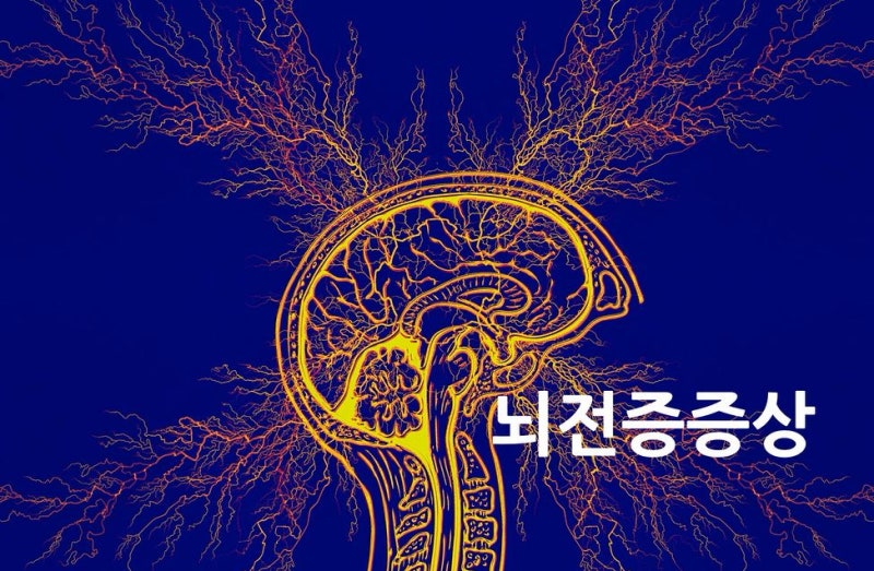 뇌전증 전조증상과 간질 증상 등 Ft소아 뇌전증 뇌전증 군면제 네이버 블로그